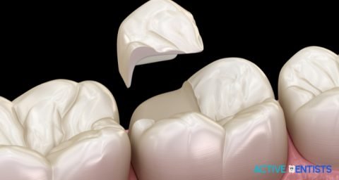 Common dental crown problems and solutions