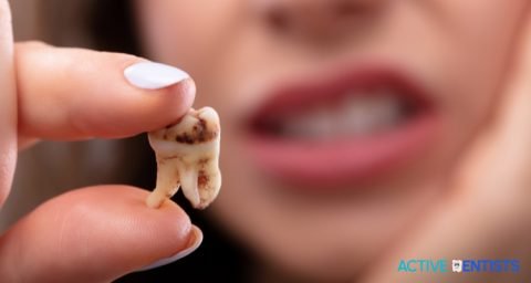 Common dental crown problems and solutions